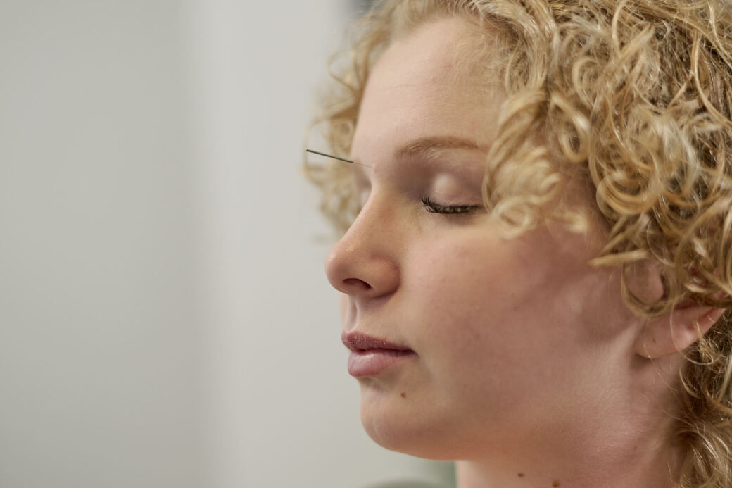 Affordable Acupuncture Norwich | Community-Style Clinic | Norwich ...